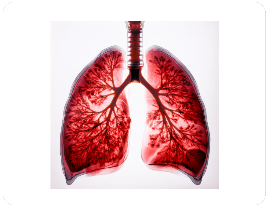 Pulmonary Fibrosis - International Center for Integrative Systems
